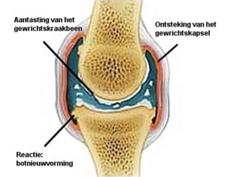 Artrose bij de hond – Dierenkliniek Balkbrug – Nieuwleusen