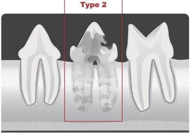 Tandresorptie bij de kat – Dierenkliniek Balkbrug – Nieuwleusen